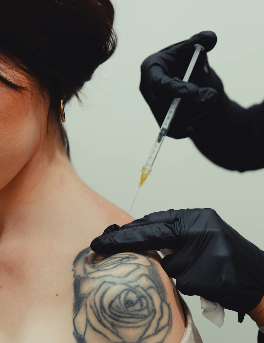 Shoulders and Trap TOX Treatments in California and Arizona – NAKEDMD ...