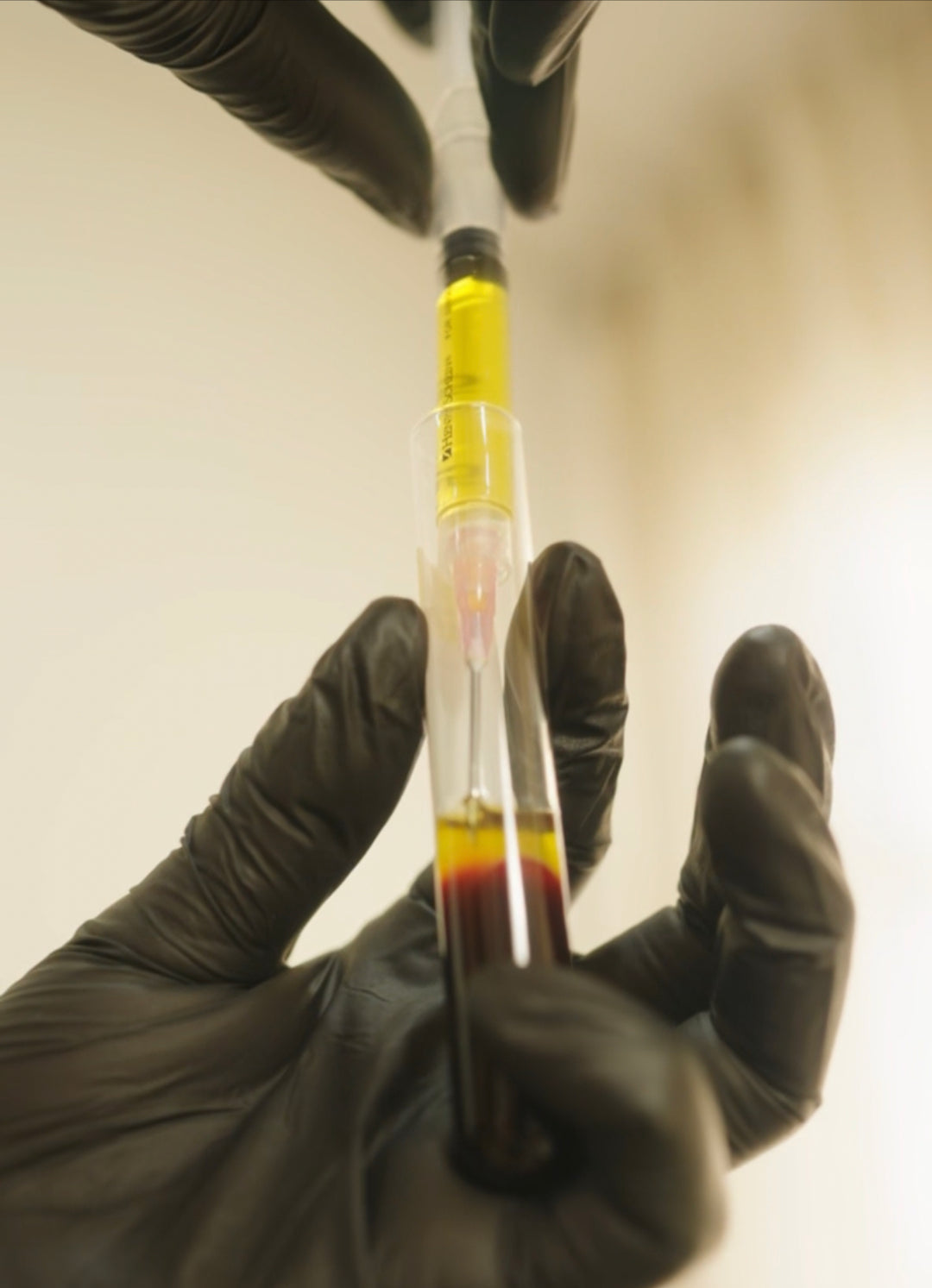 PRF (Platelet Rich Fibrin) Injection – NAKEDMD Medspa